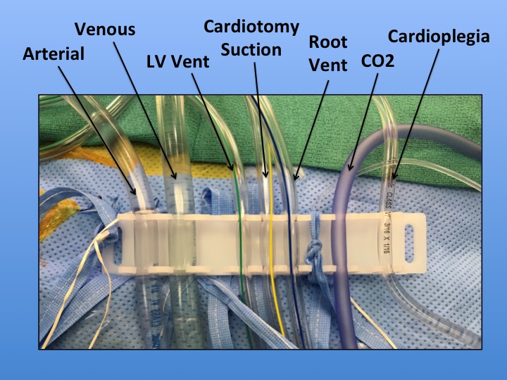 AVR – Cardiothoracic Surgery Trainer