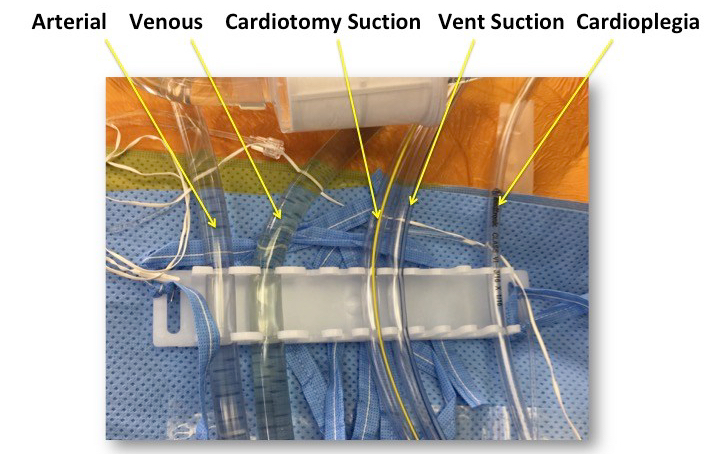 Pump Tubing and Stopcock Settings – Cardiothoracic Surgery Training